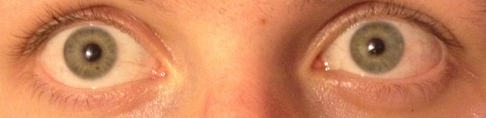 Fragen zu meinem Schielen | Optometrie Online